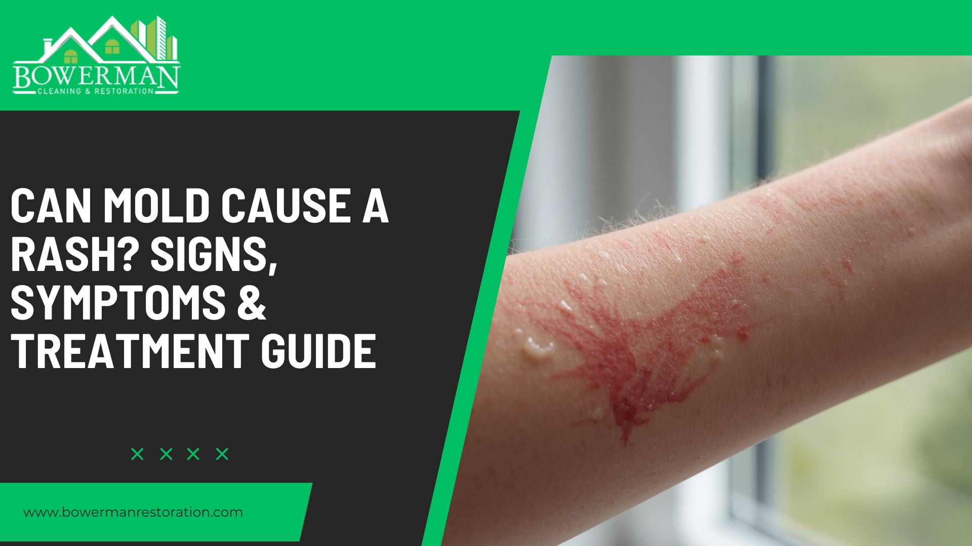 Can Mold Cause a Rash? Signs, Symptoms & Treatment Guide